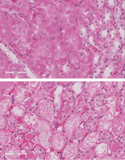 Kidney degeneration and regeneration