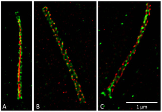 Cilia Biology and Cystic Kidney Disease
