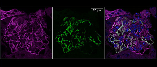 Podocyte signaling and glomerular biology