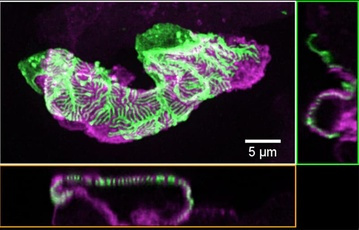 Podocyte signaling and glomerular biology
