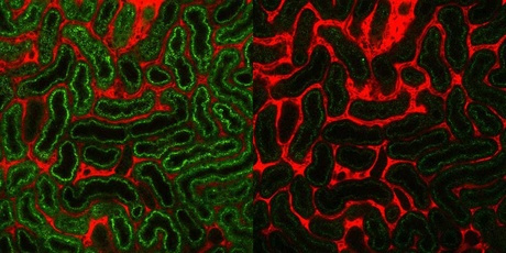 In vivo imaging of the mouse glomerulus