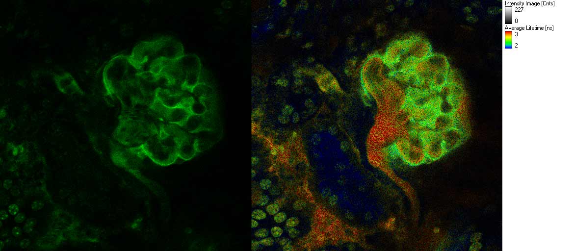 In vivo imaging of the mouse glomerulus