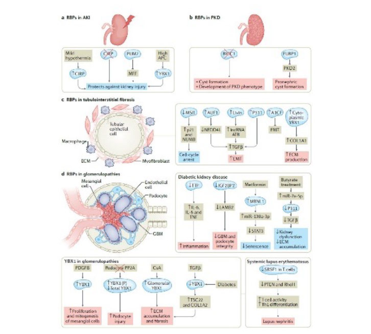 RNA-biology and metabolism in kidney disease
