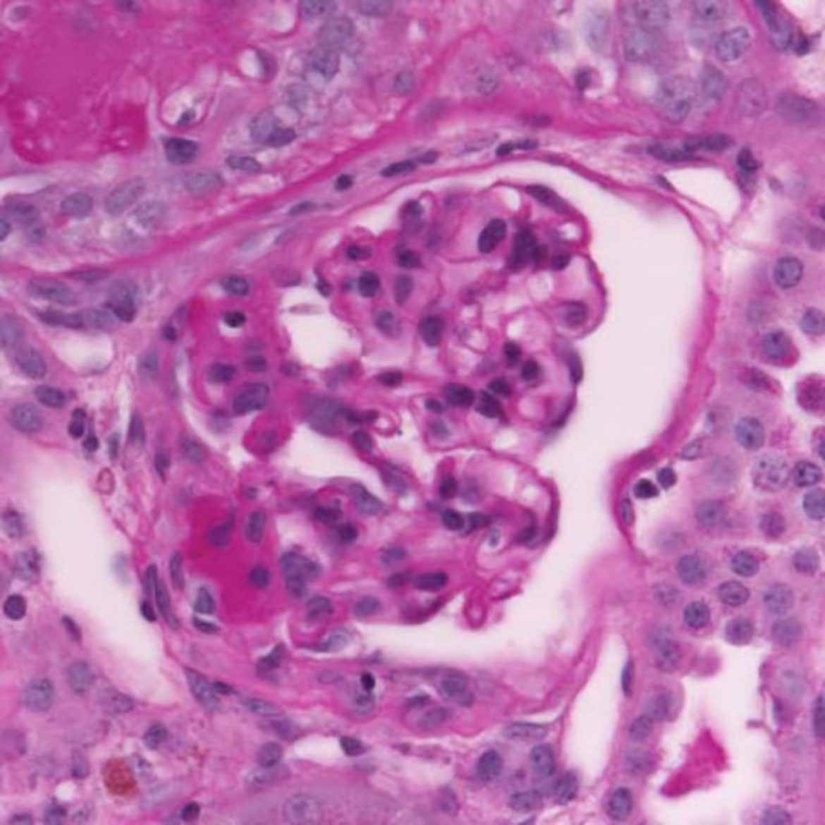 Transcriptional Networks in Podocytes - Nephrolab Cologne